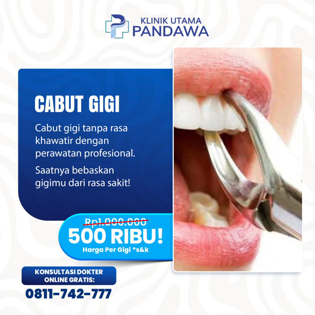 Spesialis Gigi dan Mulut – Klinik Utama Pandawa – Cabut Gigi